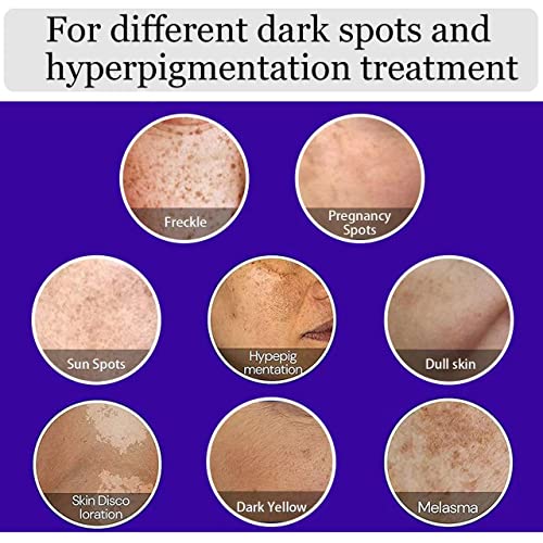 Inlifay Dark Spot Remover for Face Hyperpigmentation Treatment. Dark Spots, Melasma, Freckle, Sun Spots Removal Dark Spot Corrector Cream for Women and Men