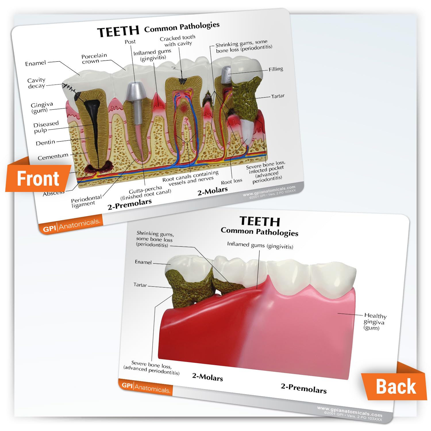 Dental Model | Human Body Anatomy Replica of Teeth w/Common Pathologies for Dentist Office Educational Tool | GPI Anatomicals