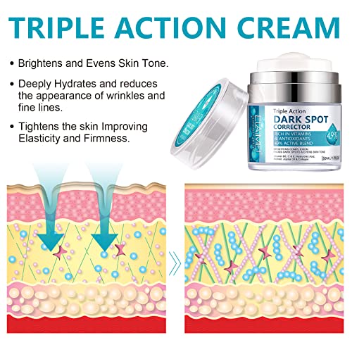 Dark Spot Remover For Face, Dark Spot Corrector and Remover, Sun Spots Melasma Freckle Remover, Packed with vitamins and natural extracts to treat dark spots, age spots, or sunspots (A)