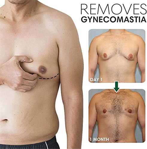 Endxedio SoliPac Gynecomastia Tightening Ginger Cream,Gynecomastia Tightening Ginger Cream,Effectively Shrinks Men Chest Tightening Ginger Cream,Effective Remove Excess Fat (3pcs)