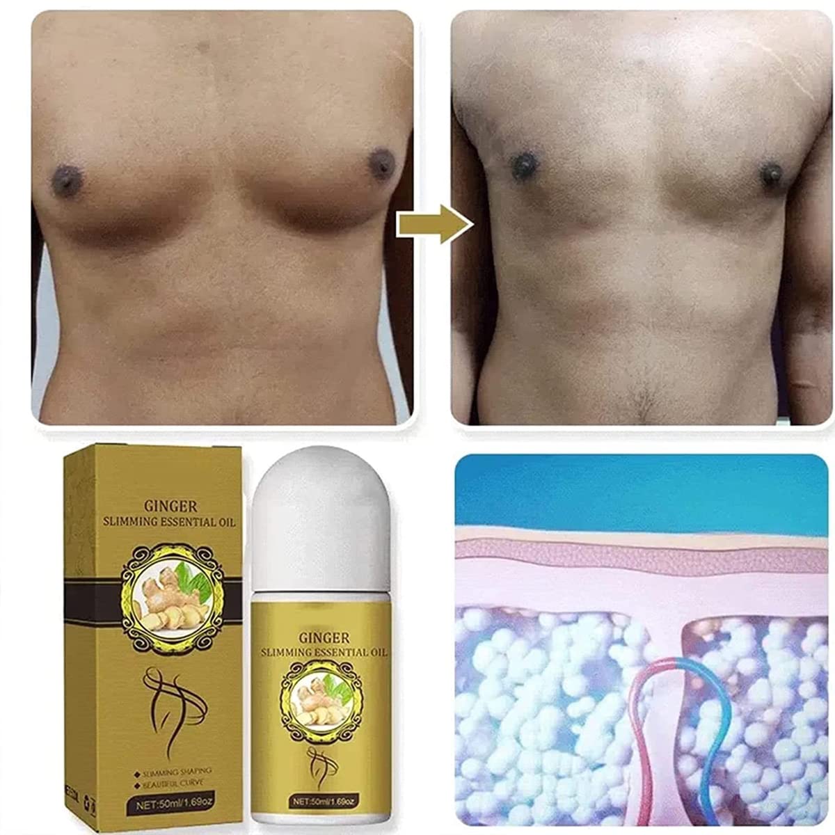 SUNRHYME PacX Gynecomastia Firming Ginger Roller, Gynecomastia Tightening Ginger Cream, Natural Tightening Ginger Cream Make Chest Shape Tough and Strong (1Pcs)