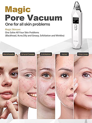 Blackhead Remover Pore Vacuum EUHOME Electric Rechargeable Blackhead Whitehead Acne Comedone Pimple Extractor Facial Pore Cleaner Blackhead Removal Kit 5 Suction Probes Face Cleaning Tools