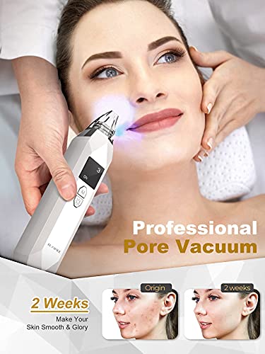 Blackhead Remover Pore Vacuum EUHOME Electric Rechargeable Blackhead Whitehead Acne Comedone Pimple Extractor Facial Pore Cleaner Blackhead Removal Kit 5 Suction Probes Face Cleaning Tools