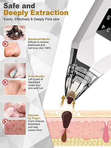 Blackhead Remover Pore Vacuum EUHOME Electric Rechargeable Blackhead Whitehead Acne Comedone Pimple Extractor Facial Pore Cleaner Blackhead Removal Kit 5 Suction Probes Face Cleaning Tools