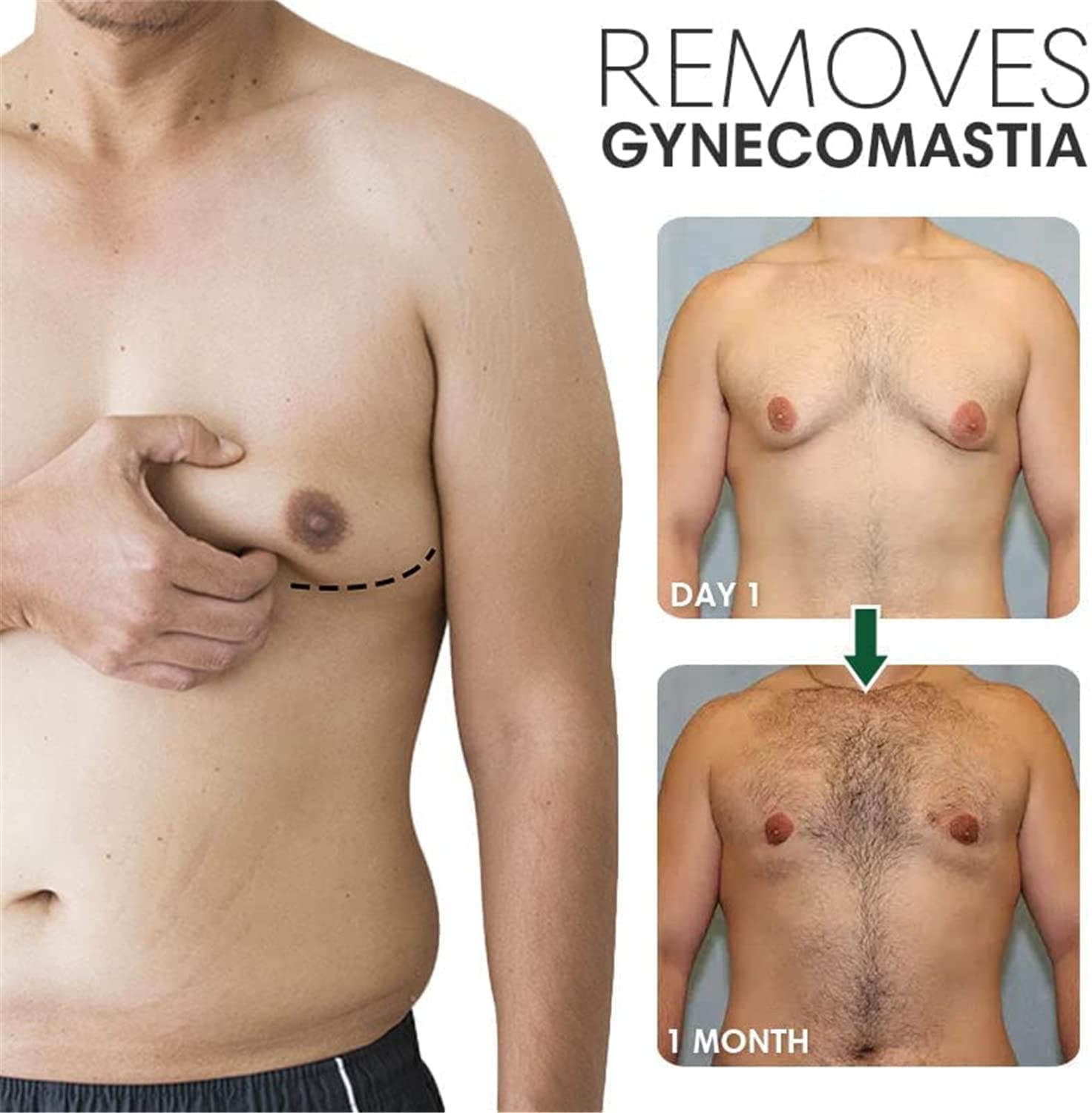 Aolodoo SoliPac Gynecomastia Tightening Ginger Cream,Gynecomastia Tightening Ginger Cream,Fat Burning Anti-Cellulite Slimming Cream,Effective Remove Excess Fat (3pcs)