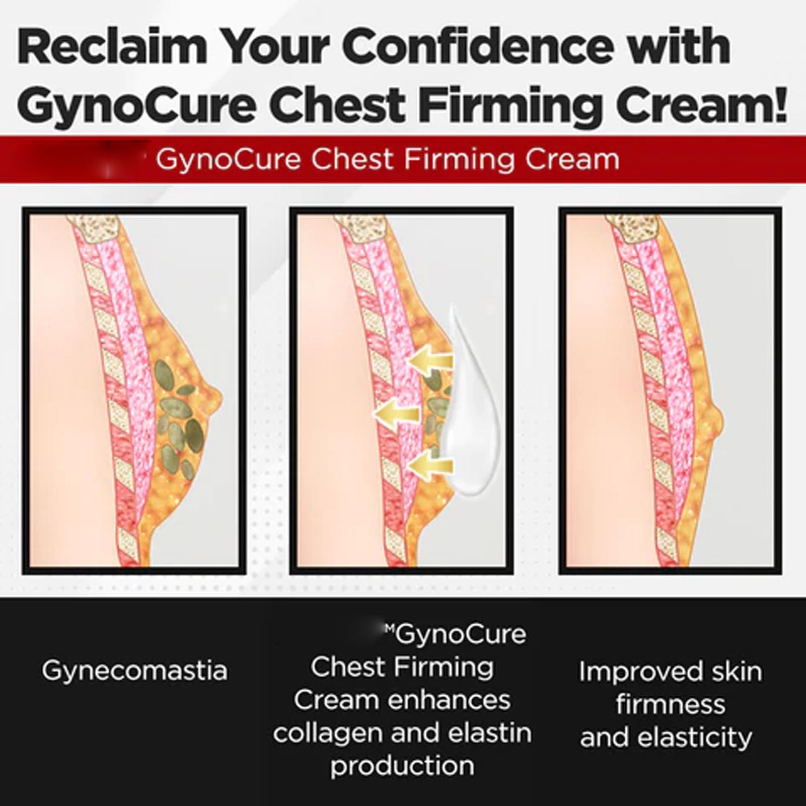 SLPB Gynocure Chest Firming Cream, 60g Gynecomastia Tightening Cream for Men, Hot Cream Anti Cellulite Cream (1Pcs)