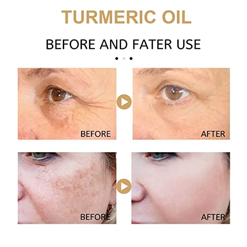 2022 New Turmeric Dark Spot Corrector Serum,Natural Turmeric Dark Spot Corrector Serum for Face, Skin Care Moisturizing Repair Serum(2PCS-60ml)
