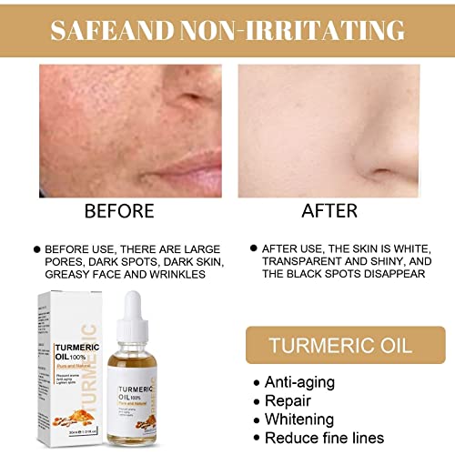 2022 New Turmeric Dark Spot Corrector Serum,Natural Turmeric Dark Spot Corrector Serum for Face, Skin Care Moisturizing Repair Serum(2PCS-60ml)