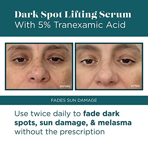 Dark Spot Lifting Serum with 5% Tranexamix Acid