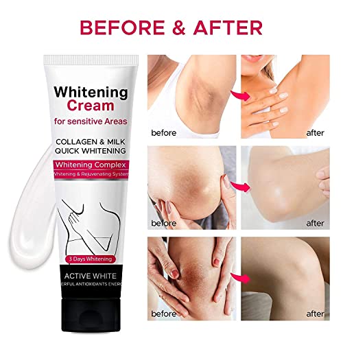 Crema Aclaradora Para Piel Manchas En Cara Axilas Cuello Entrepierna-n3