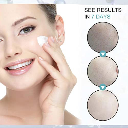 3 Pack Dark Spot Cream For Face,Dark Spot Remover For Melasma,Skin Spot Remover Cream,Freckle Remover Cream,Age Spot Remover,Dark Spot Cream For Women & Men (2 Pack)