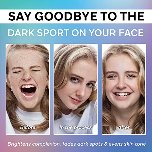 Dark Spot Remover for Face,Dark Spot Corrector Serum,Hyperpigmentation Treatment,Advanced and Natural Formula - - Removes Freckles, Sun Spots, Melasma and More