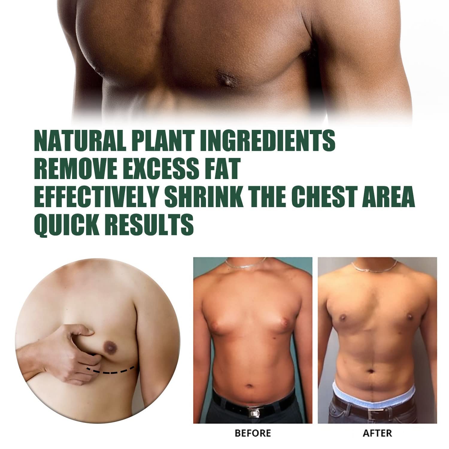YG LianKai 2pcs Gynecomastia Tightening Ginger Cream, Ginger Cream for Men, Effectively Shrinks Men Chest Tightening Ginger Cream