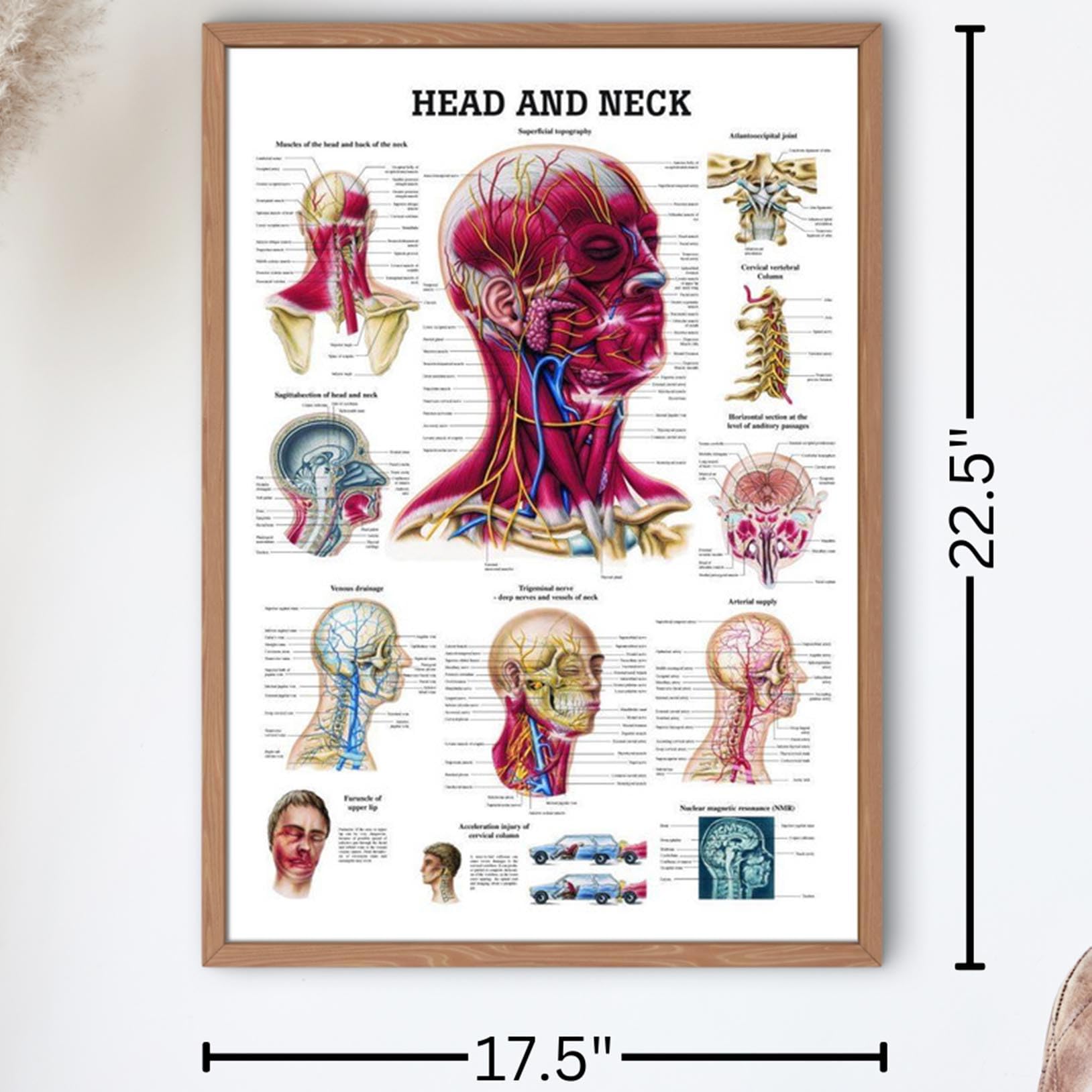 Head and Neck Laminated Anatomy Chart