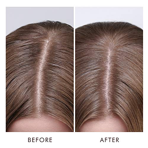 Moroccanoil Dry Scalp Treatment, 1.5 Fl. Oz.