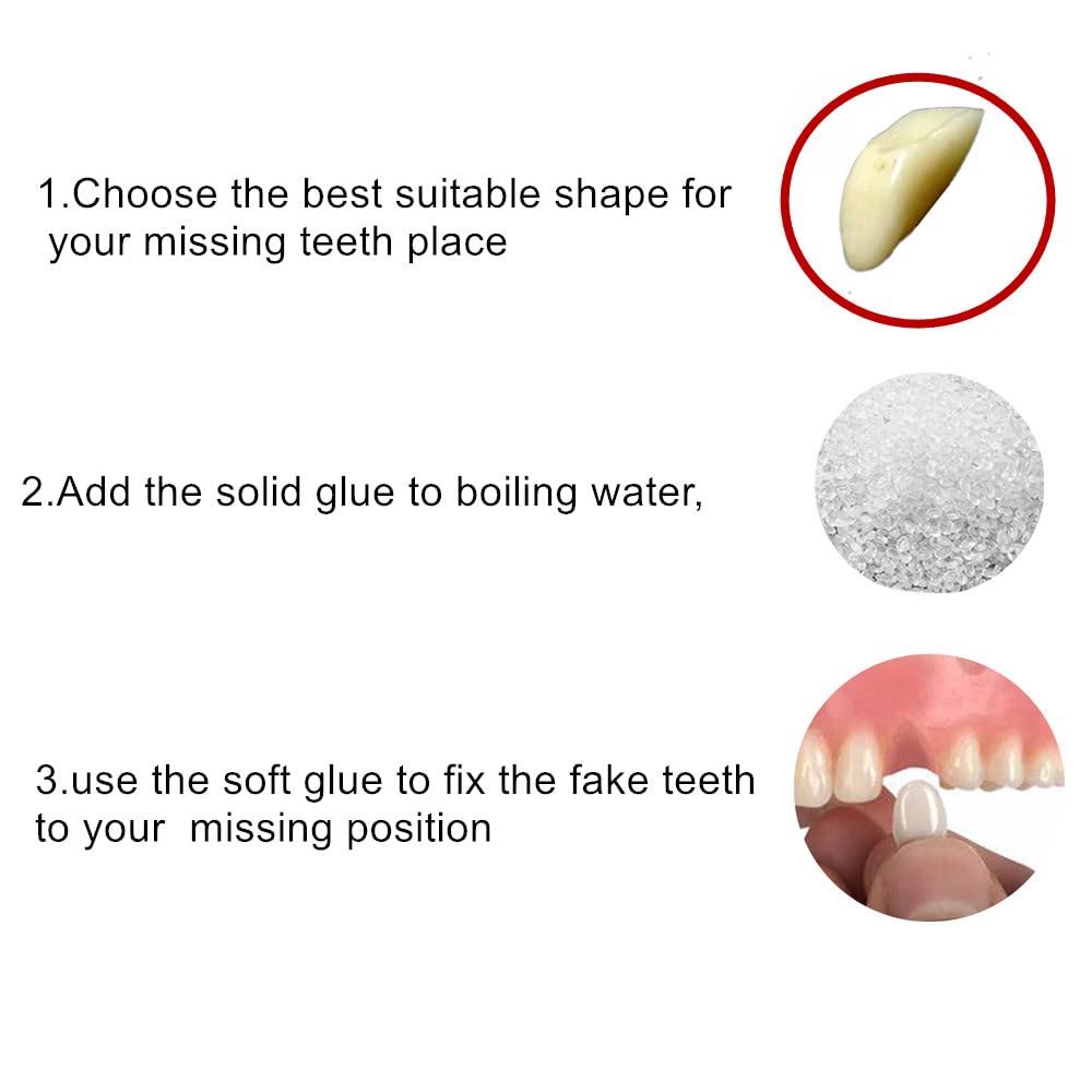 sowsmile Upper and Lower Temporary Missing Teeth Tooth Gap Repair Fix Replacement Solution, Confident Snap on Instant Perfect Smile kit