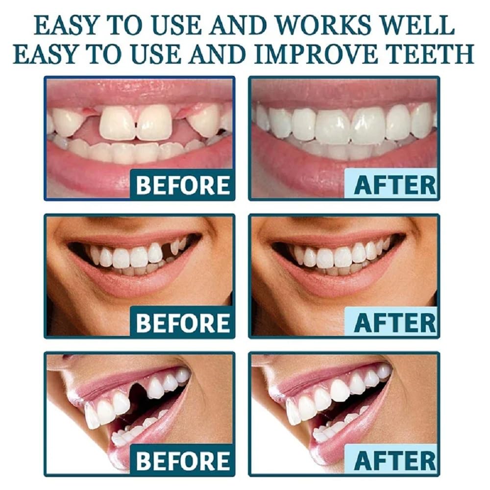 Renyqatt 2PCS Fake Teeth Adjustable Veneers Dentures Teeth for Women and Men Temporary Teeth Perfect Cover The Imperfect Teeth Nature and Comfortable (A)