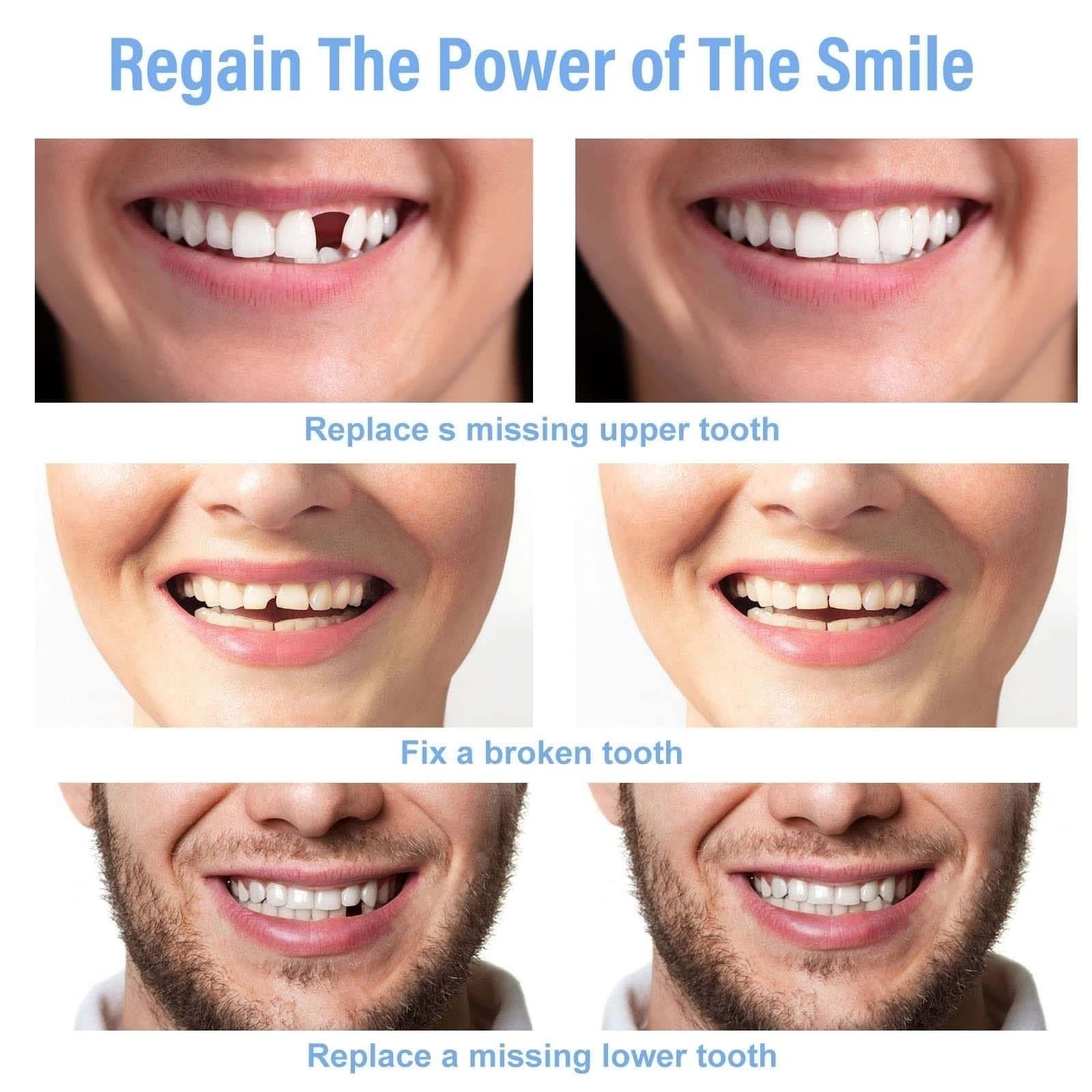 Renyqatt 2PCS Fake Teeth Adjustable Veneers Dentures Teeth for Women and Men Temporary Teeth Perfect Cover The Imperfect Teeth Nature and Comfortable (A)