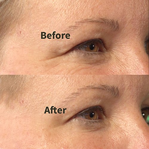Instant Firming Maxi Lift Serum - Two Minute Face Lift For A Younger Look