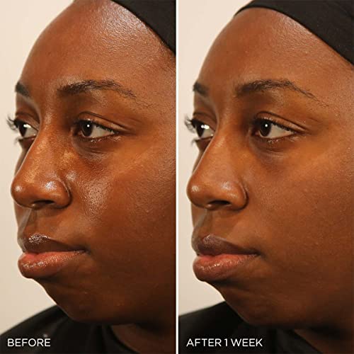 TATCHA The Clarifying Clay Mask | Exfoliating Pore Treatment Creates a Warming Sensation To Open & Purify Pores | 1.7 oz