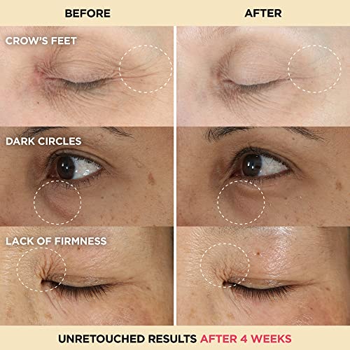 IT Cosmetics Confidence in an Eye Cream, Anti Aging Eye Cream for Dark Circles, Crow's Feet, Lack of Firmness & Dryness, 48HR Hydration with 2% Super Peptide Concentrate, for Day + Night - 0.5 fl oz