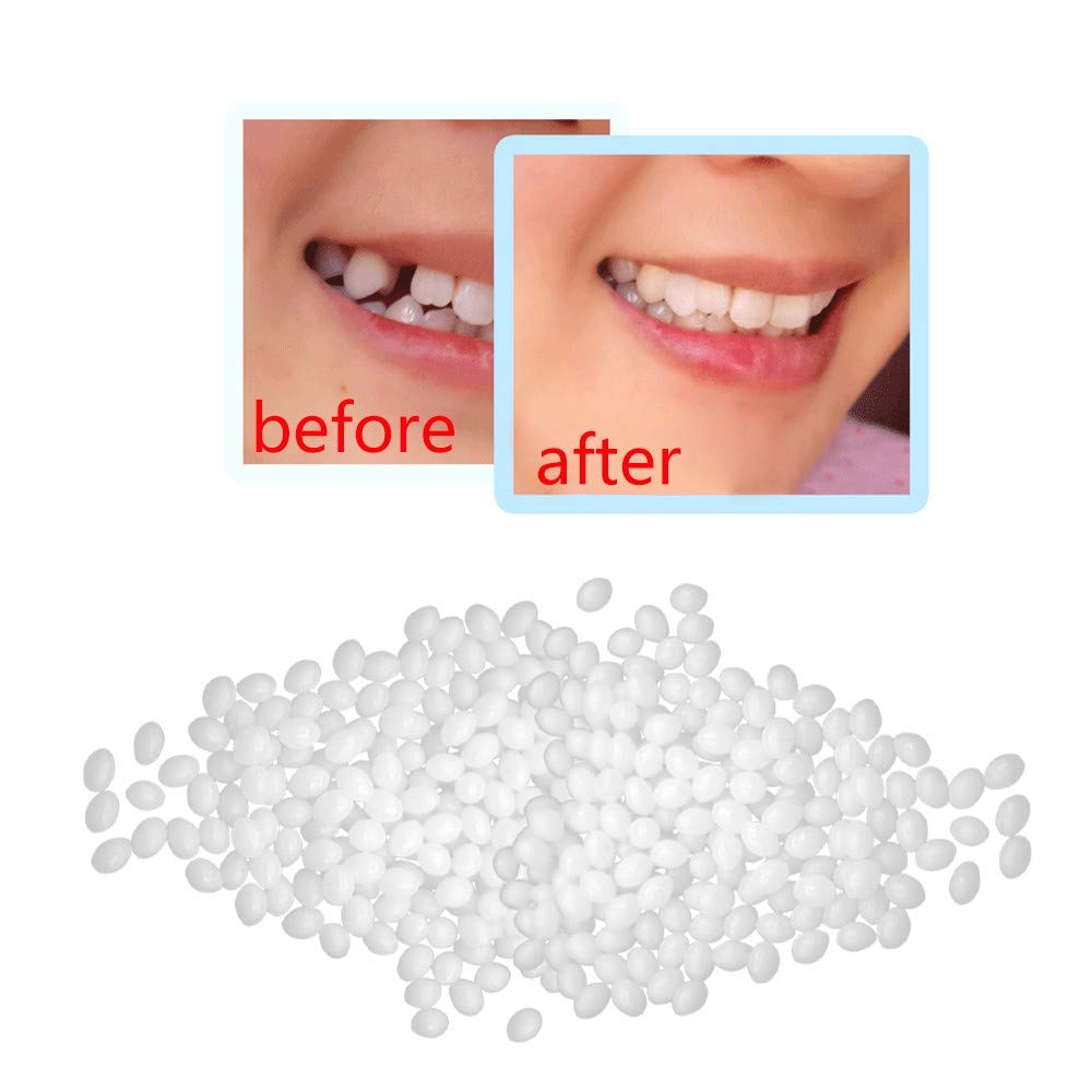 XBKPLO Multi-Functional Temporary Tooth Repair Kit Moldable Thermal Fitting Beads for Snap On Instant and Confident Smile Denture Adhesive Fake Teeth Cosmetic Braces Veneer (15g)