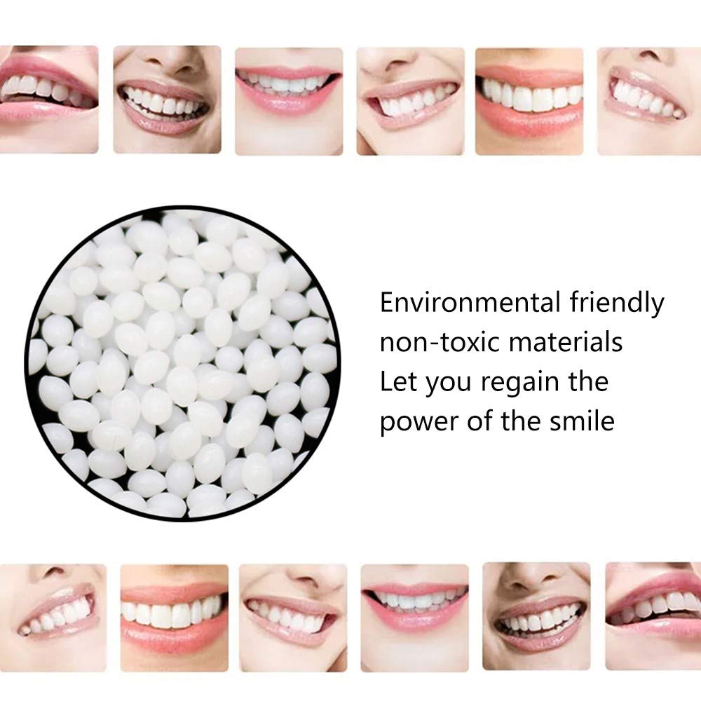 XBKPLO Multi-Functional Temporary Tooth Repair Kit Moldable Thermal Fitting Beads for Snap On Instant and Confident Smile Denture Adhesive Fake Teeth Cosmetic Braces Veneer (15g)