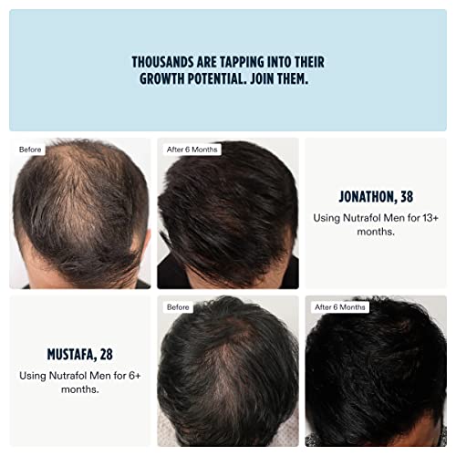 Nutrafol Men's Hair Growth Supplement | Clinically Effective for Visibly Thicker & Stronger Hair with More Scalp Coverage | Dermatologist Recommended | 1 Bottle | 1 Month Supply