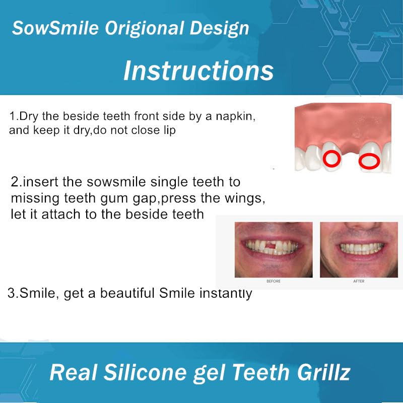 SowSmile Latest Snap Smile Dental Single Missing Teeth Gap Repairing Fake Toothth Cover Perfect Smile Veneers