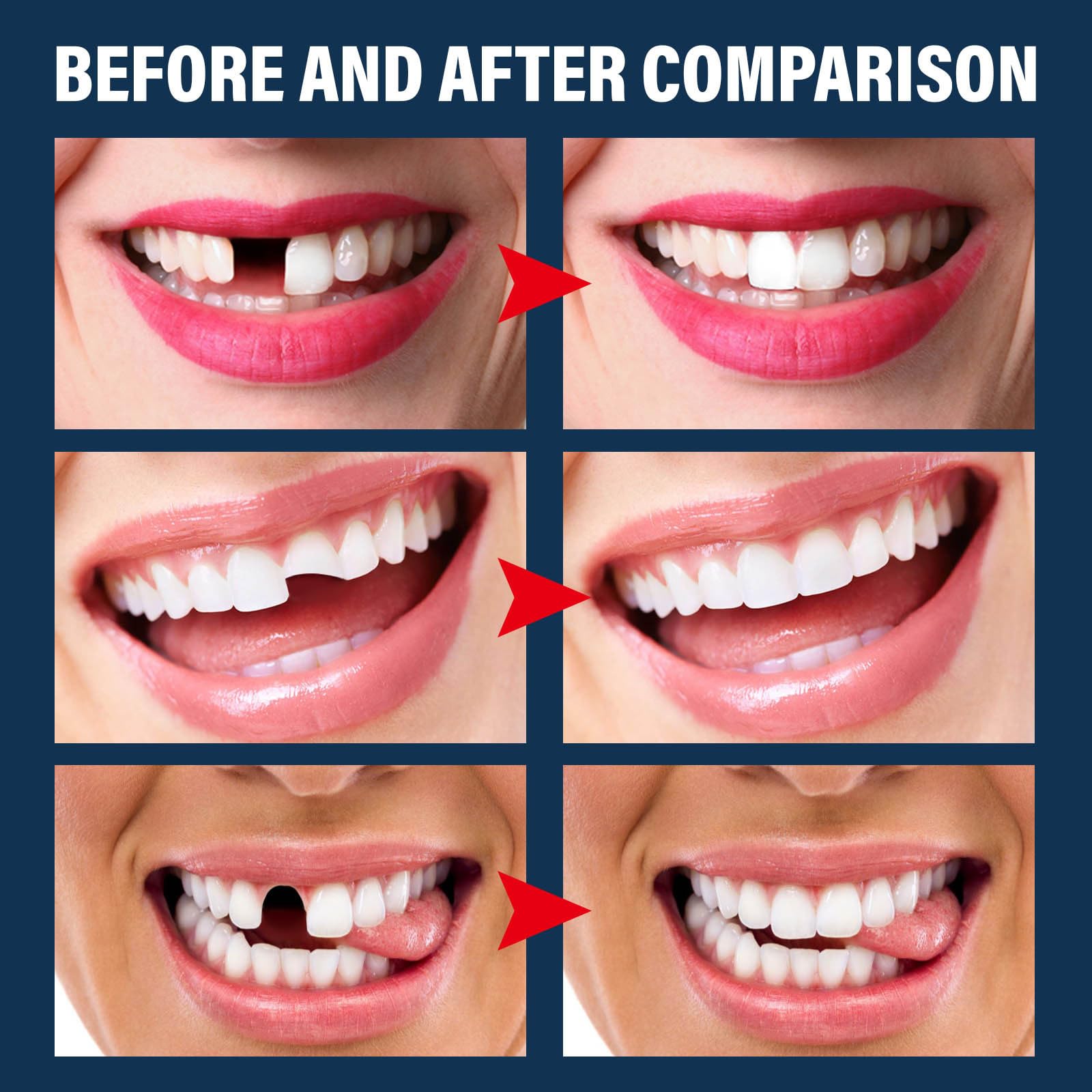 120 Pieces Fake Tooth Cap Crown Veneers Front Back Anterior and Molar Posterior Teeth with Tooth Repair Thermal Beads Cap Filler for Taching or DIY
