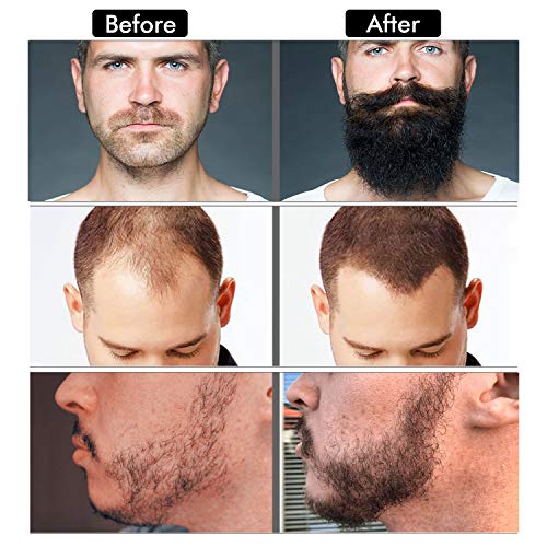 Beard Growth Kit - Derma Roller for Beard Growth, Beard Growth Serum Oil (2oz), Beard Balm and Comb, Stimulate Beard and Hair Growth - Gifts for Men Dad Him Boyfriend Husband Brother
