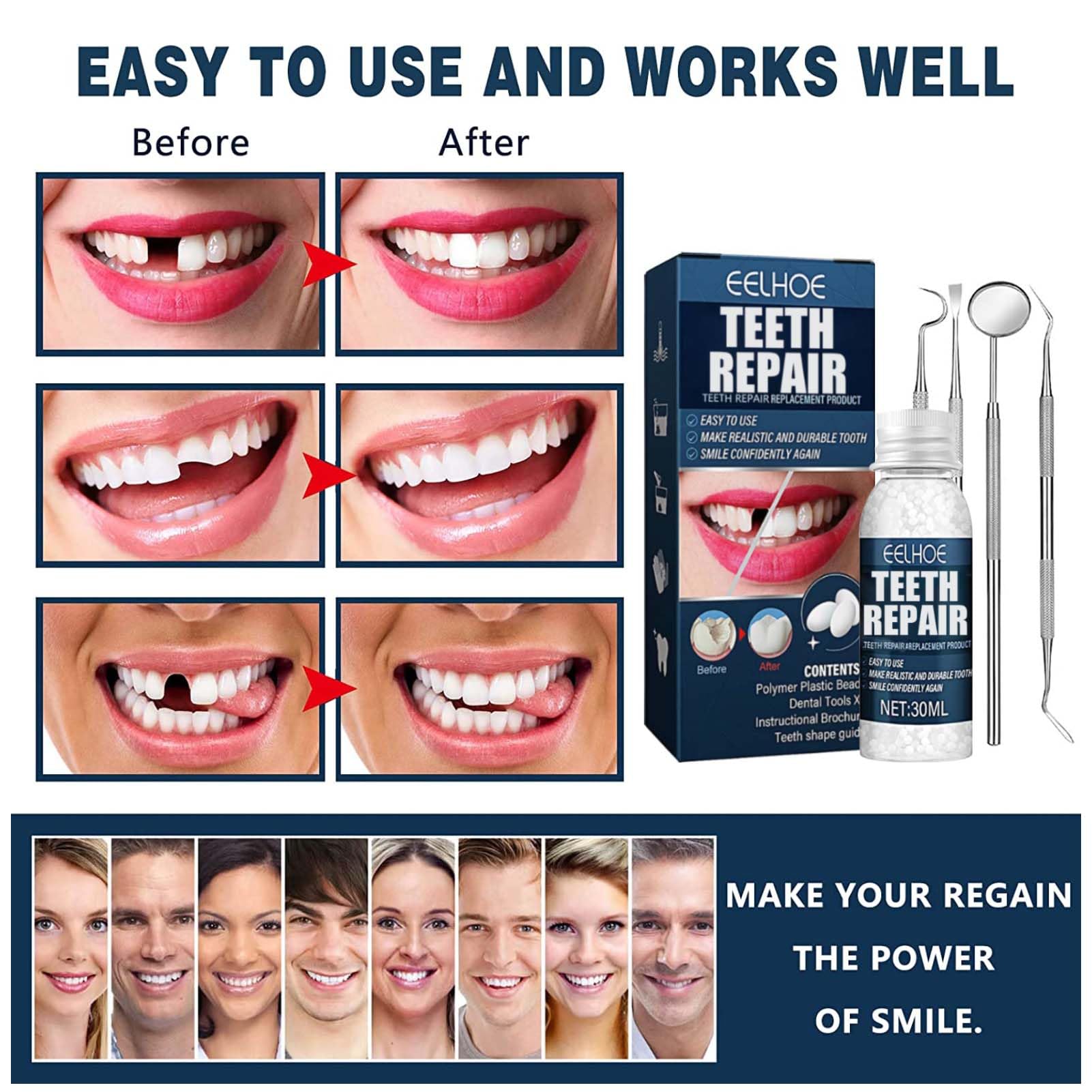 Teeth Repair Kit,Tooth Repair Kit for Missing Teeth, Cavity Filler for Teeth,Temp Tooth Beads with 4 Dental Tools, Repair Missing or Broken Teeth, Snap On Instant and Confident Smile