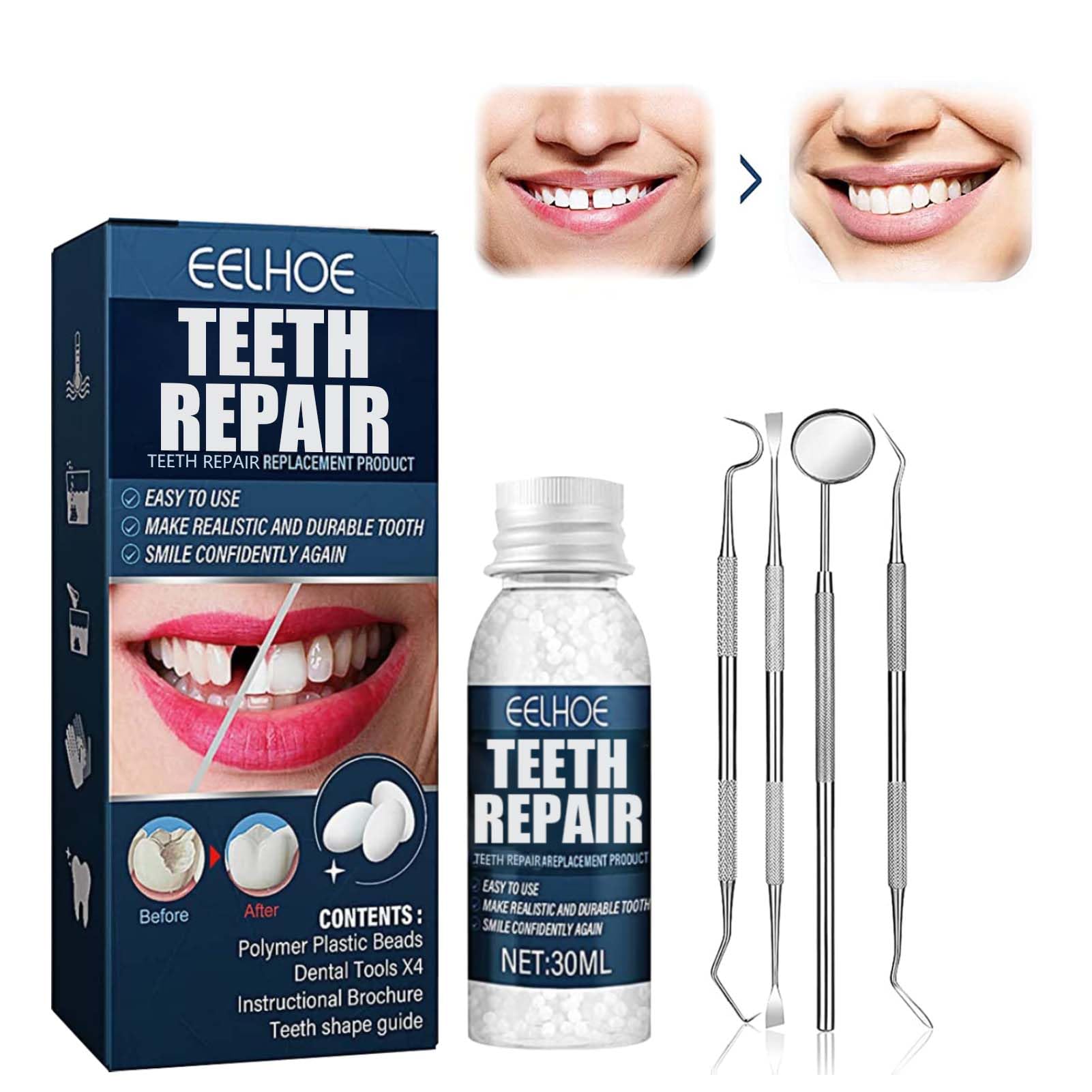 Teeth Repair Kit,Tooth Repair Kit for Missing Teeth, Cavity Filler for Teeth,Temp Tooth Beads with 4 Dental Tools, Repair Missing or Broken Teeth, Snap On Instant and Confident Smile