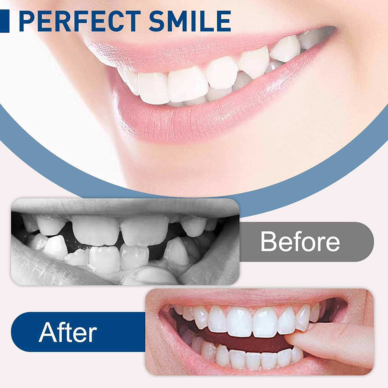 Tooth Repair, Cover The Imperfect Teeth,Fix Your Smile at Home Within Minutes!,Upper and Lower Whitening Teeth Sets2pcs
