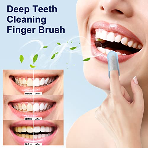 MySmile 100pcs Teeth Wipes Disposal Finger Brush Deep Cleaning Teeth Wipes Oral Brush Up Tooth Wipes for Teeth Cleaning Mint Flavor