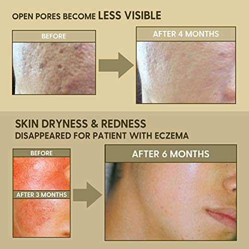 Le Revital 98% Concentrated Nano Placenta Extract, Umbilical Extract & Sodium Hyaluronate Anti-Aging Serum from Japan – Skin Rejuvenate Essence - Reduce Wrinkles, Dark Spot + Hydration – Non-greasy