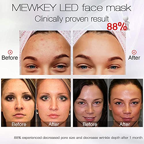 NEWKEY Led Face Mask Light Therapy, 7 Led Light Therapy Facial Skin Care Mask - Blue & Red Light for Acne Photon Mask - Korea PDT Technology for Acne Reduction