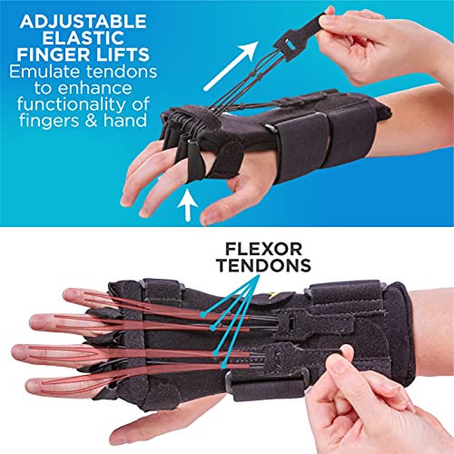 BraceAbility Radial Nerve Palsy Splint - Dynamic Wrist Drop and Limp Finger Extension Brace for Saturday Night, Honeymoon, and Crutch Palsy Treatment (One Size)