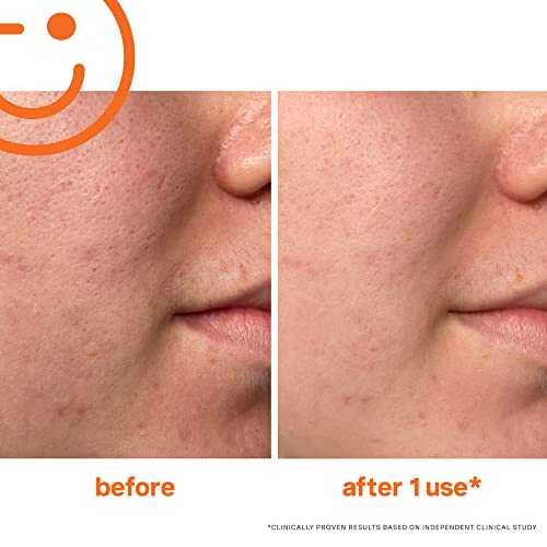 Kate Somerville ExfoliKate Intensive Exfoliating Treatment β Salicylic Acid and Lactic Acid Super Facial Scrub Improves Texture and Pores, 0.5 Fl Oz