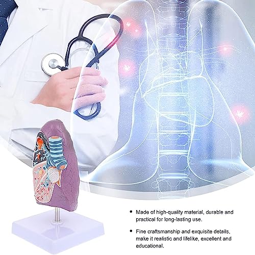 Anatomy Model Human Lung Model Human Pathological Lung Teaching Model, Internal Organs Champion Surgery, for Medical Demonstration Organs Model