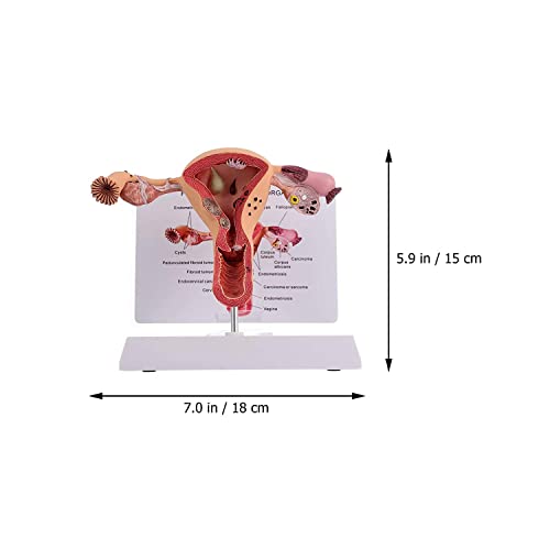 ROLTIN Human Pathological Uterus Model Internal Reproductive System Organ Anatomical Model Human Anatomy Model for Medical Training Aid
