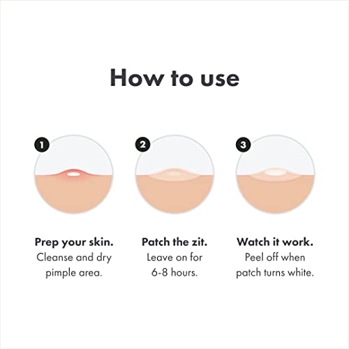 Mighty Patch Original from Hero Cosmetics - Hydrocolloid Acne Pimple Patch for Covering Zits and Blemishes, Spot Stickers for Face and Skin, Vegan-friendly and Not Tested on Animals (72 Count)