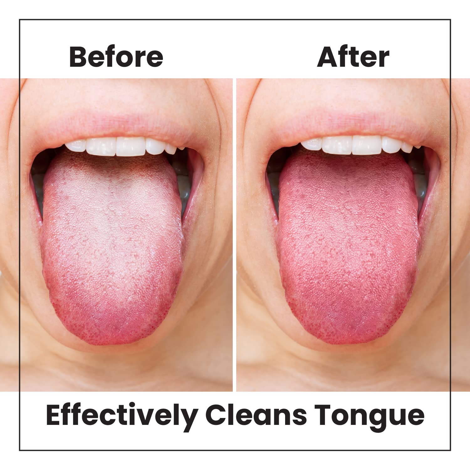 Lindo Eco-Friendly Tongue Cleaners, Tongue Scrapers, Oral Care Cleaners, Reduce Bad Breath, Soft Silicone Bristles, Natural, Vegan, 2 Pack