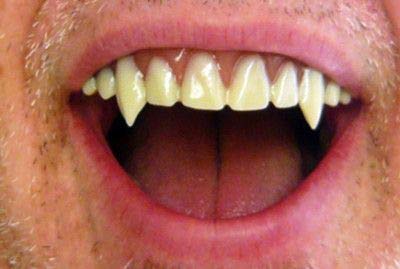 Nightslayer Vampire Movie Quality FX Fangs