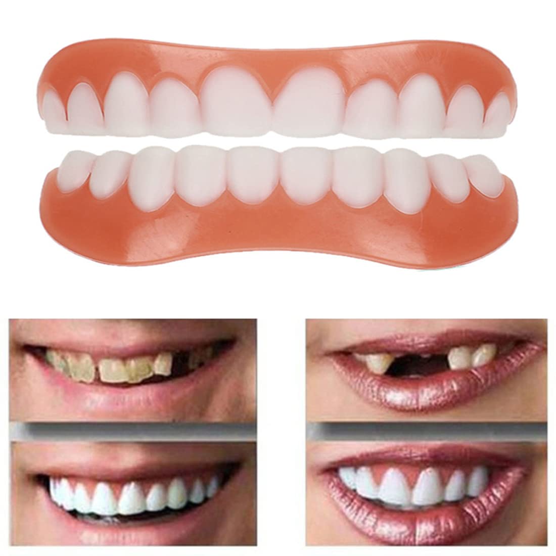 GYTOO Fake Teeth,Veneer Cosmetic Teeth for Upper and Lower Jaw,Natural Shade and Comfortable Fit,Veneer Dentures For Women and Men