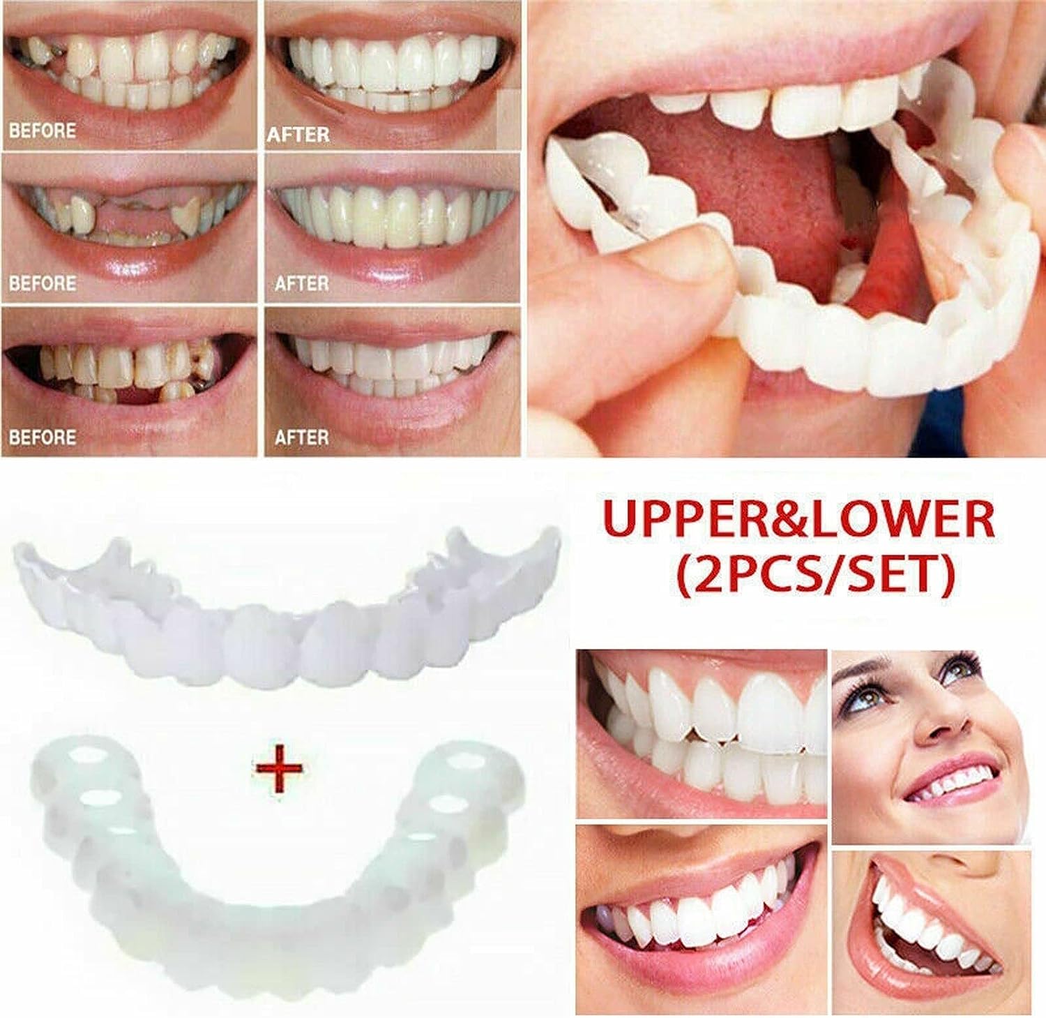2 Pairs of occlusal Tooth veneers and Smiling Tooth veneers to Protect and Cover Imperfect Teeth, and whitening Braces to Keep Teeth White and Tidy,… (Large Size)