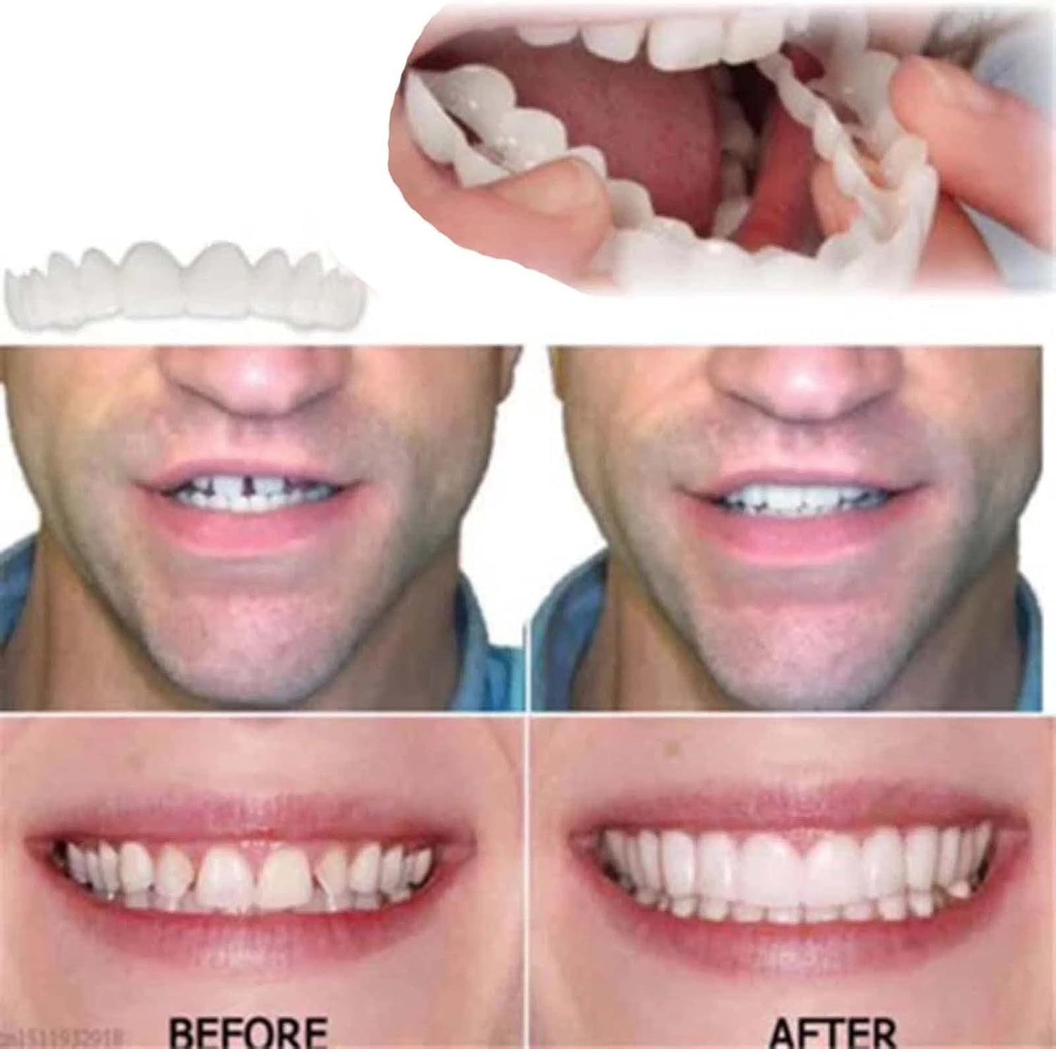 2 Pairs of occlusal Tooth veneers and Smiling Tooth veneers to Protect and Cover Imperfect Teeth, and whitening Braces to Keep Teeth White and Tidy,… (Large Size)