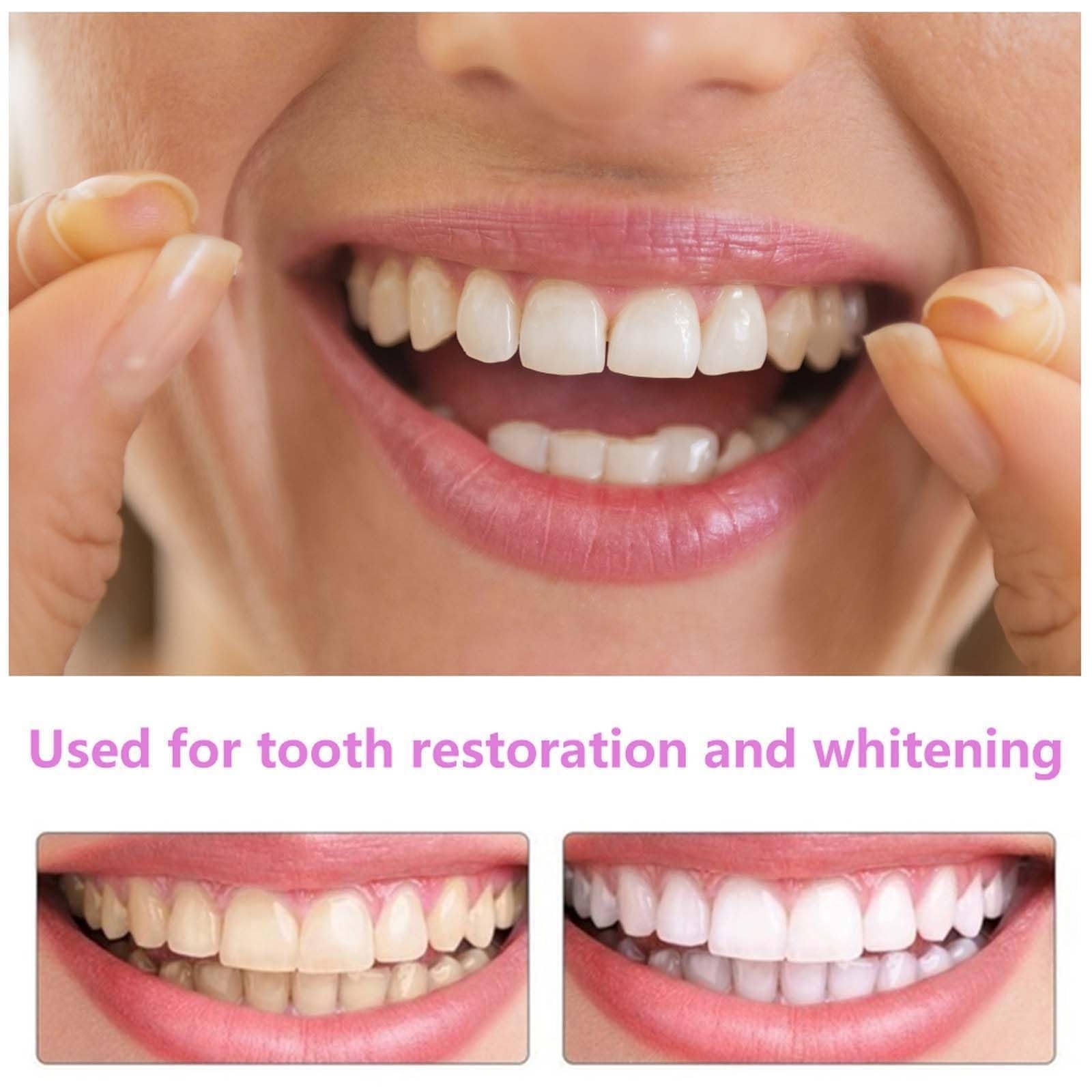 Aimery Fake Teeth,2 PCS Dentures Teeth for Women and Men, Natural Shade Fake Veneer, Denture Decorations for Halloween, Christmas and Daily Life (Teeth1)