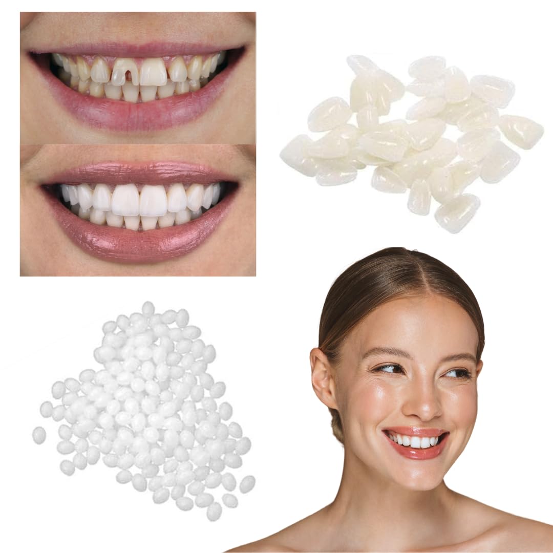 Tooth Replacement Kit, Replace a Missing Tooth in Minutes, Veneers for Temporary Tooth Repair, Complete Your Smile with Temporary Tooth, Nature and Comfortable Veneers