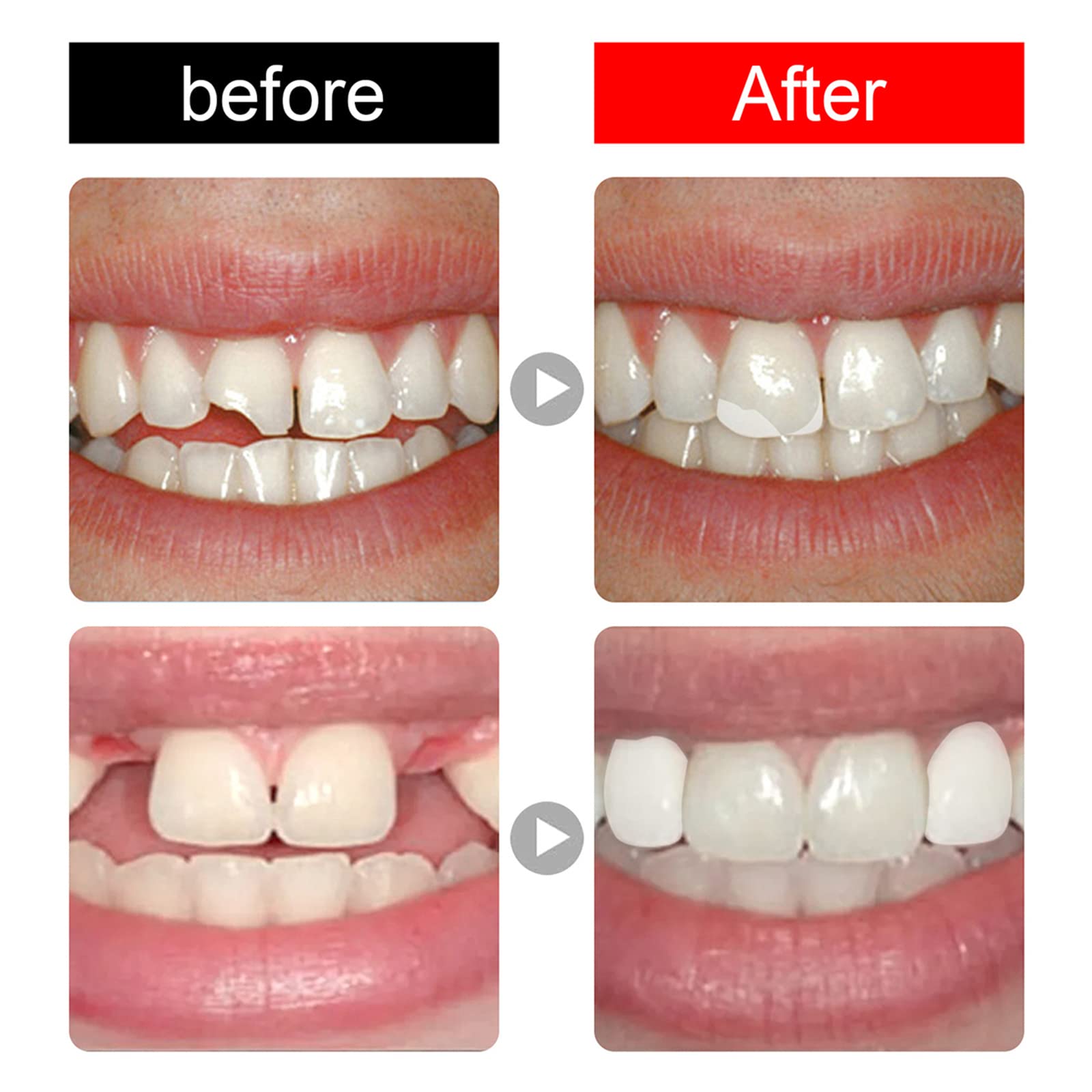 168 Pieces False Teeth Dental Complete Acrylic Resin Denture Teeth, 6 Sets Whole Teeth Synthetic Polymer Denture Tooth, 23 Shade A2 Upper + Lower Dental Materials for Replacement, DIY, or Halloween
